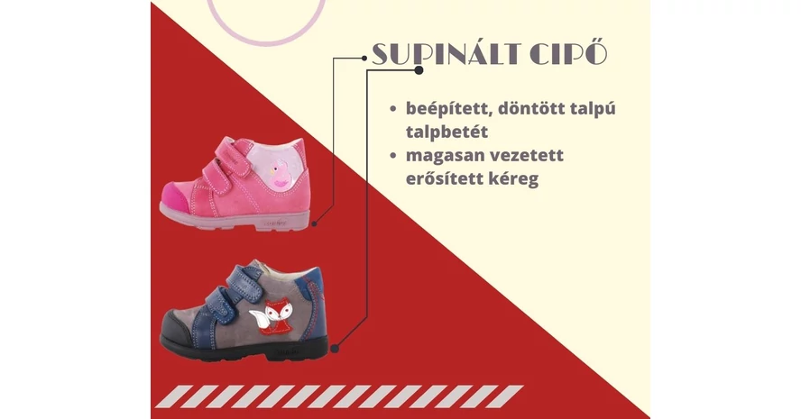 A tudomány ajándéka vagy csupán egy üres lufi? A supinált cipő